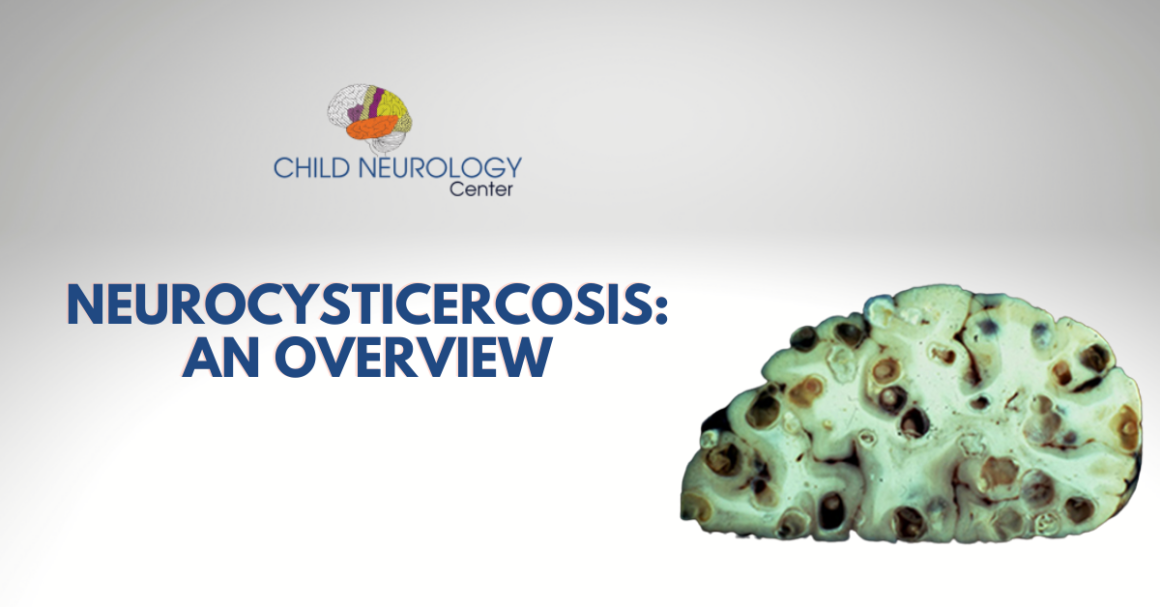 Neurocysticercosis: An Overview - Child Neurology