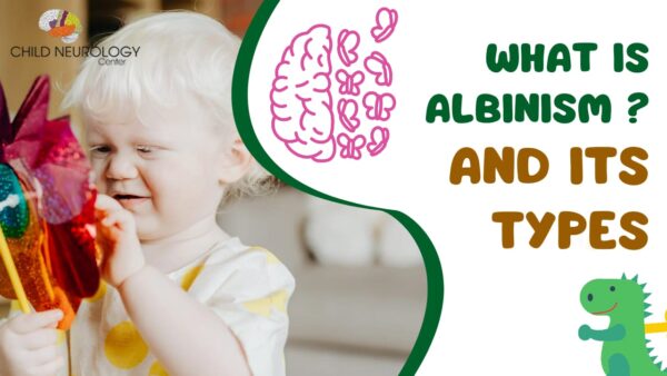 What is Albinism and its types - Child Neurology